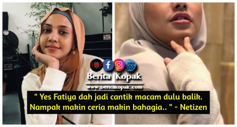 Yes Fatiya dah jadi cantik macam dulu balik.. ” - Netizen | Berita Kopak CC