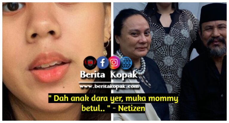 Dah anak dara yer, muka mommy betul.. ” - Netizen | Berita Kopak CC