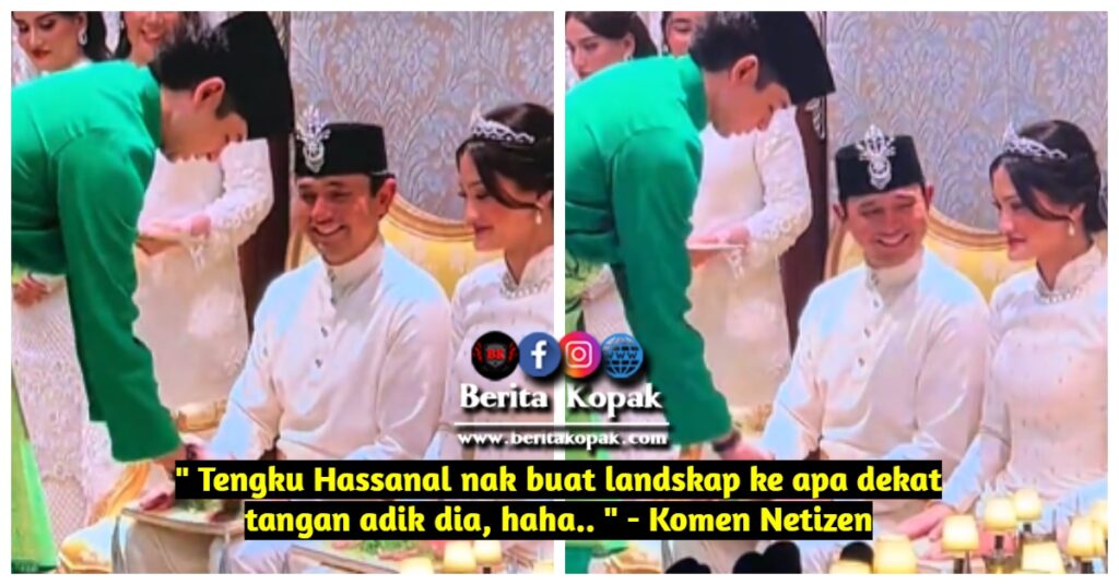 Tengku Hassanal nak buat landskap ke apa dekat tangan adik dia, haha ...
